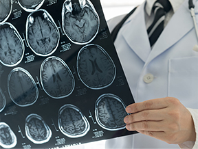 Home: Neurologische Fachpraxis Dr. med. Ruhnke | Dr. med. Thomsen